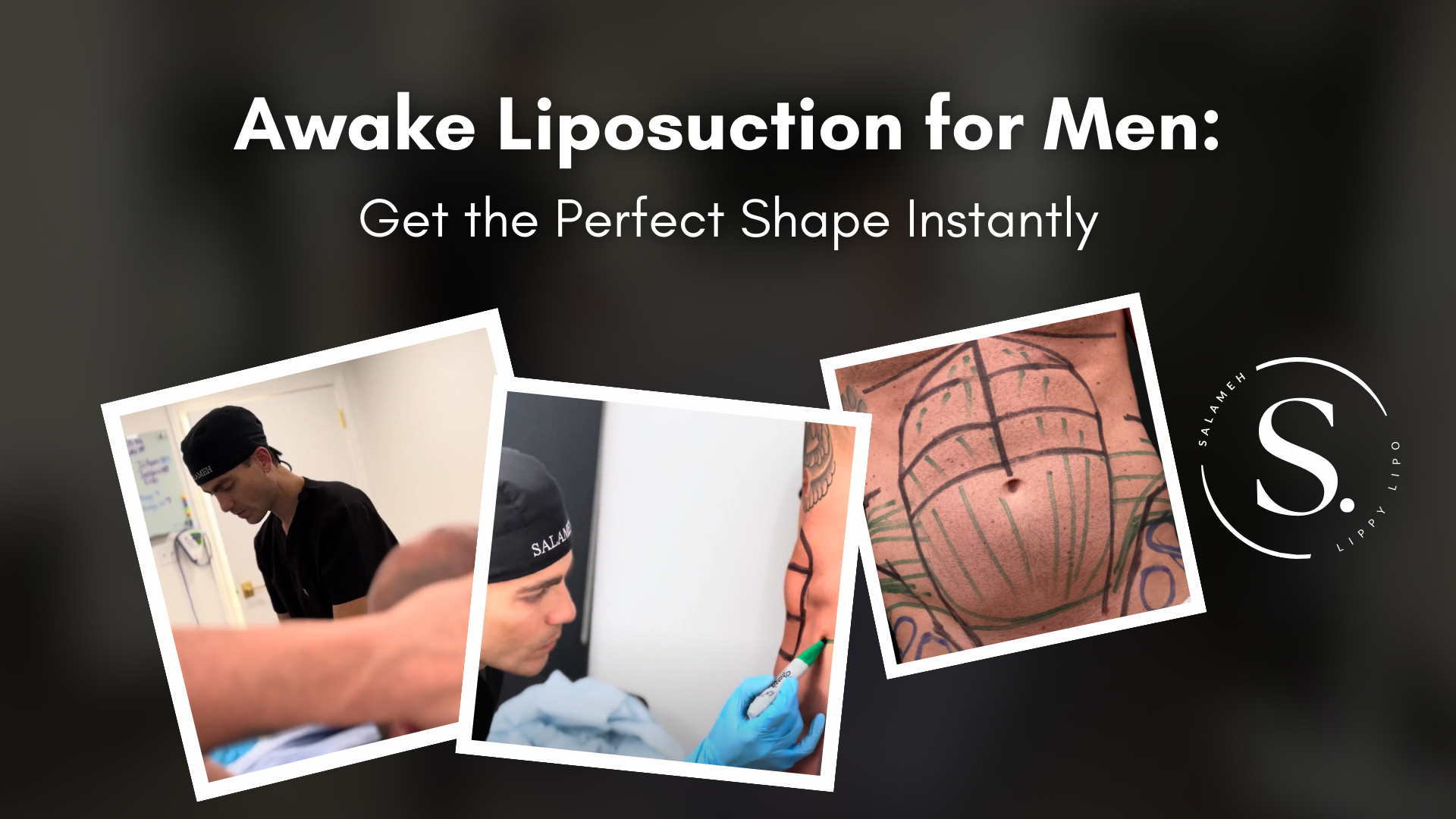 Awake Liposuction for Men: Get the Perfect Shape Instantly